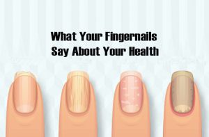 What Your Fingernails Say About Your Health - MindWaft