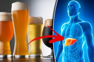 The Effects of Alcohol on the Liver - MindWaft